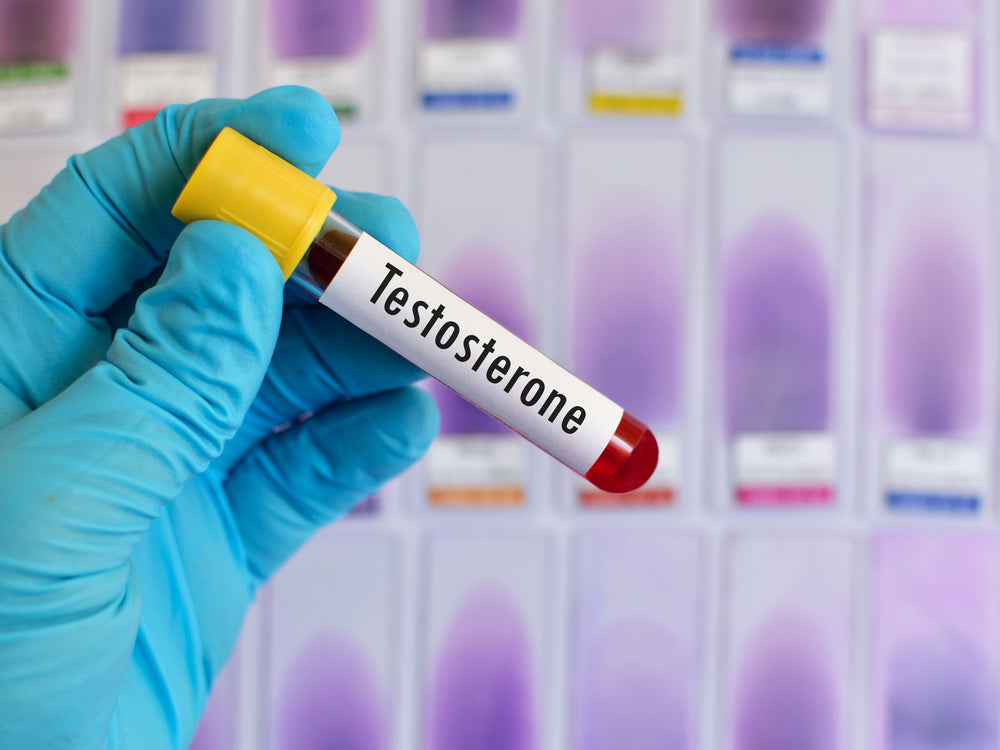 Serum Testing for Male Hormones: Total, Free, and Bioavailable Testost ...