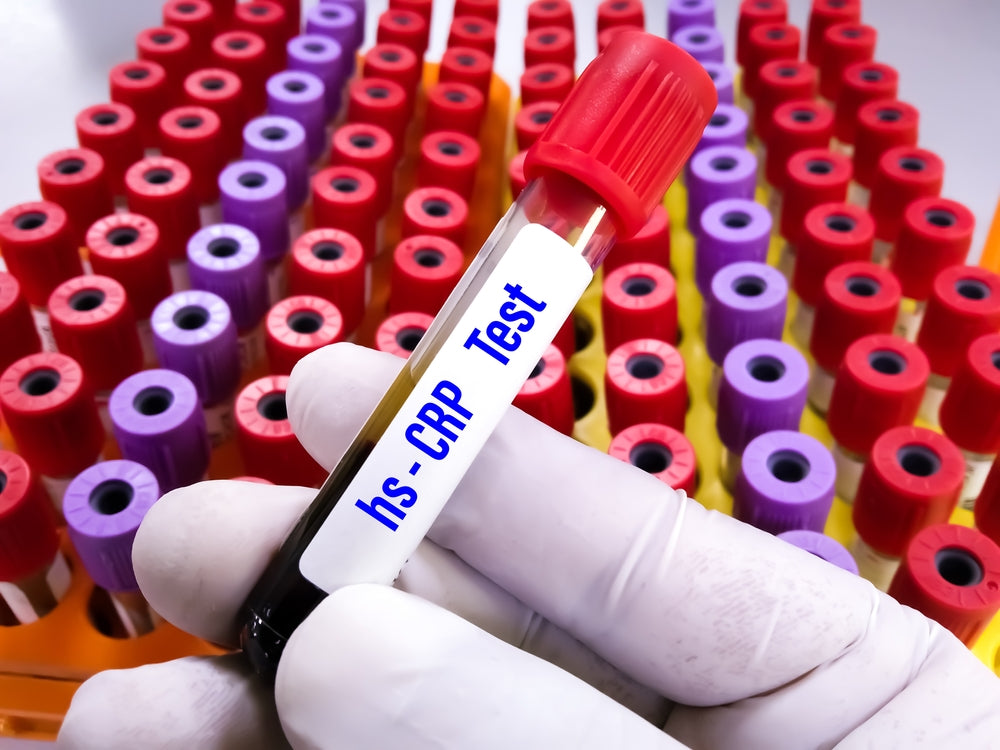High-Sensitivity C-Reactive Protein (hs-CRP) – Revolution Health & Wellness